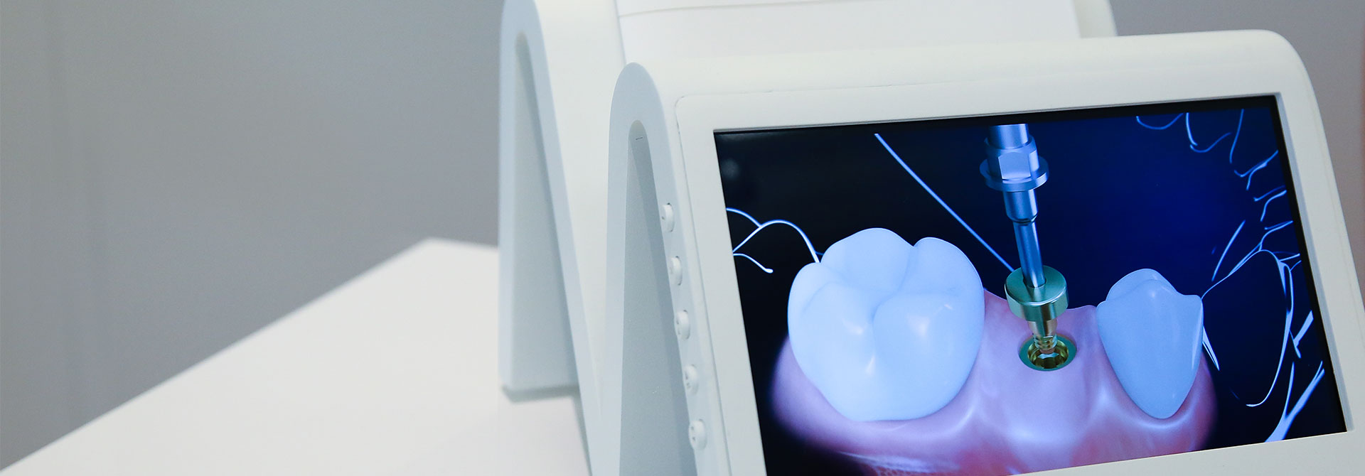 MIS - Dental Implants Technology | MIS Dental Implants