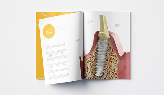 SEVEN - Internal hex. implant system by MIS