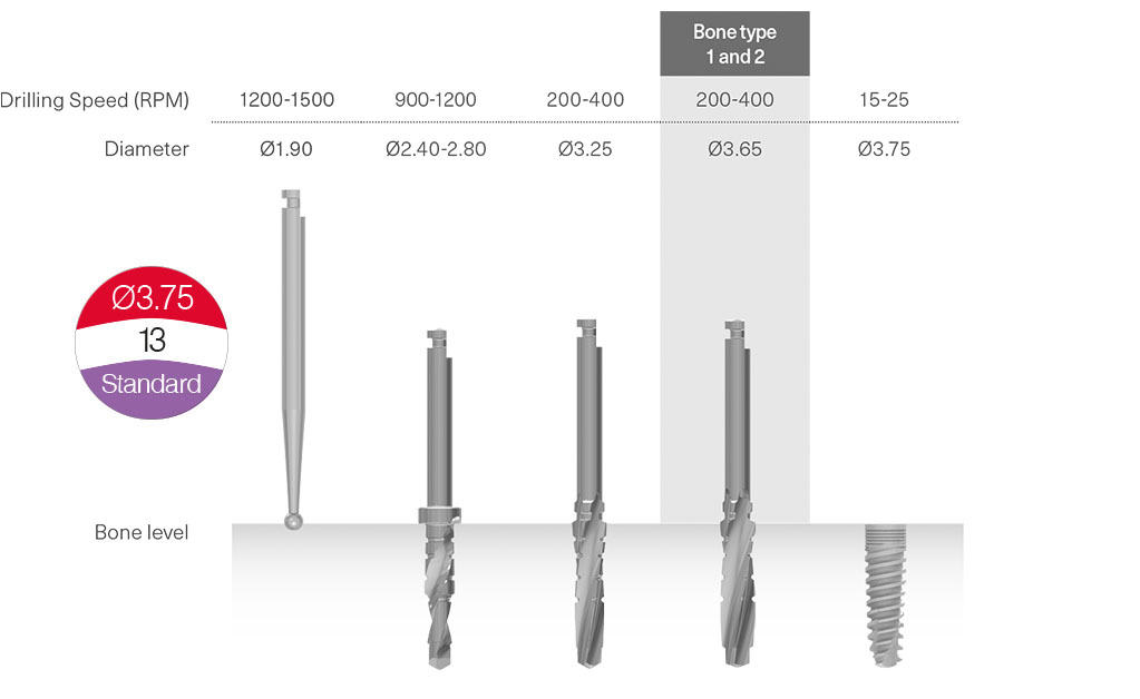 MIS Dental Implants