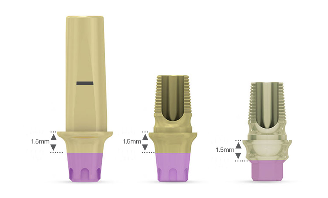 Digital Restoration | MIS Dental Implants